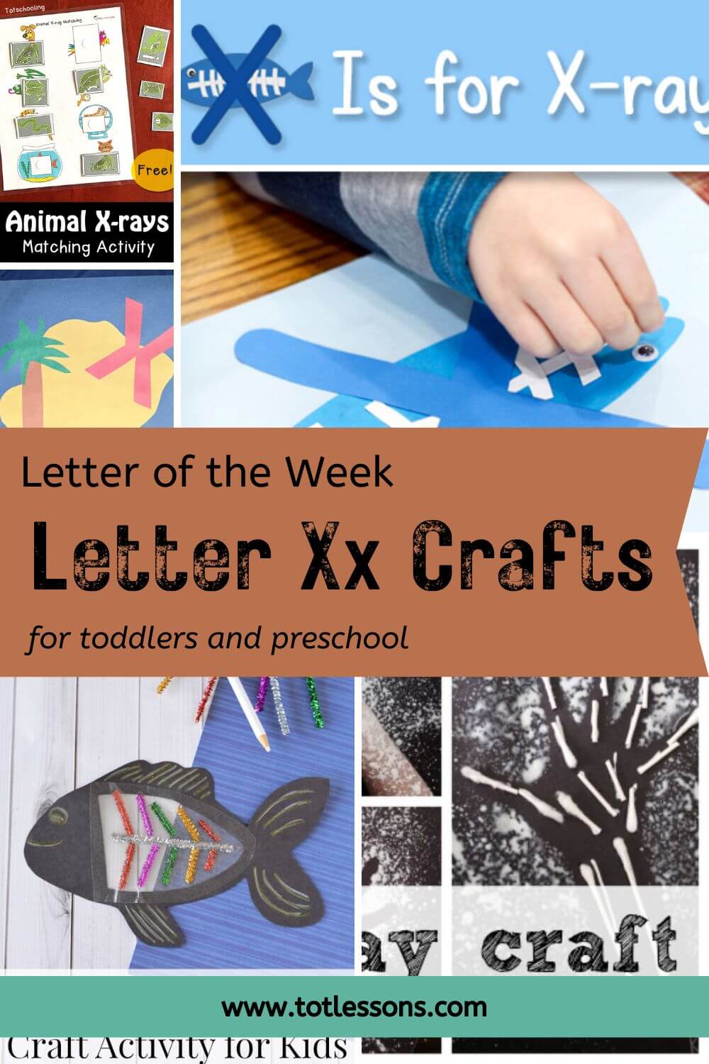 Letter of the Week Preschool Curriculum: Letter X - Printables and ...